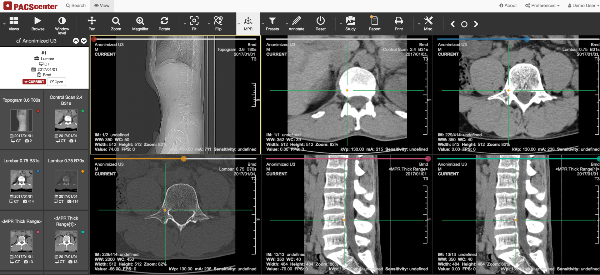 Are you familiar with all of PACScenter’s MPR tools? | BMD Software