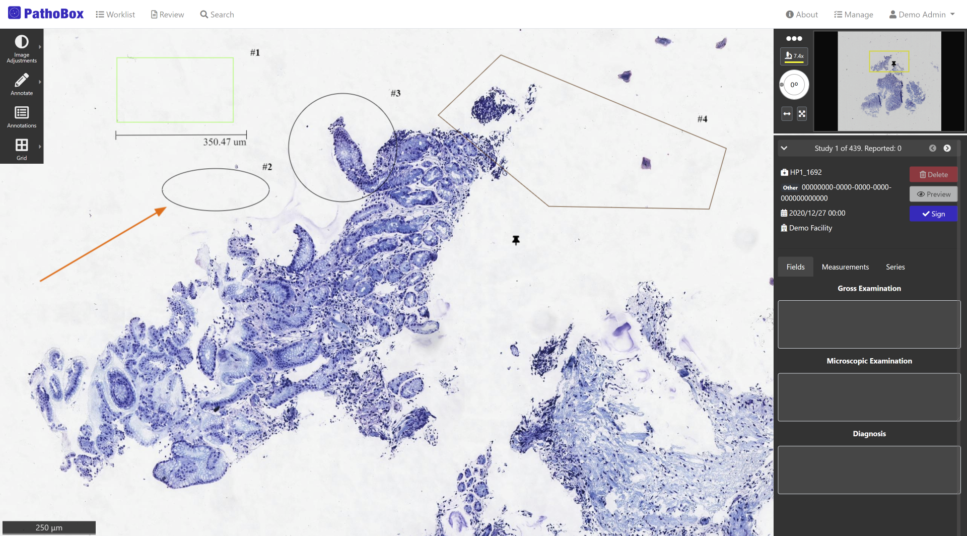 annotations - BMD Software