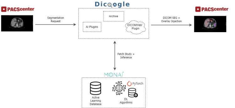 AI Segmentations in PACScenter Viewer - BMD Software